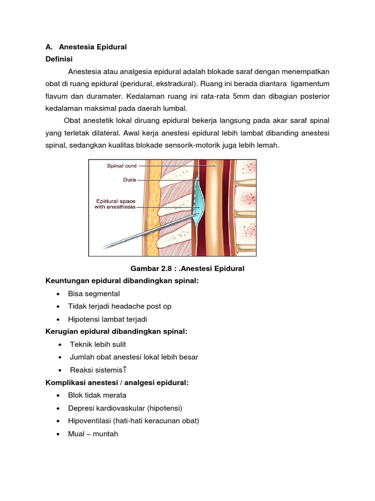 Anestesi Epidural Pdf