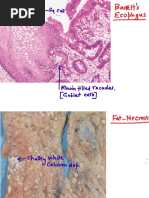 Pathoma Fundamentals of Pathology | PDF
