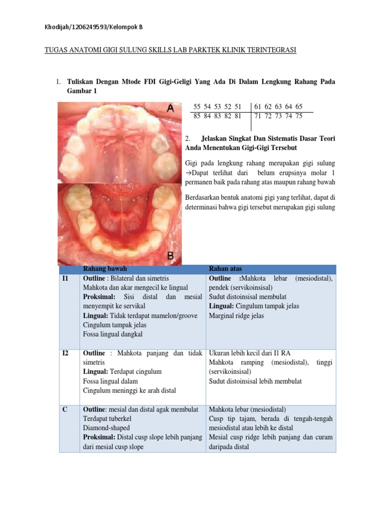 Tugas Anatomi Gigi Sulung Skills Lab Parktek Klinik Terintegrasi | PDF