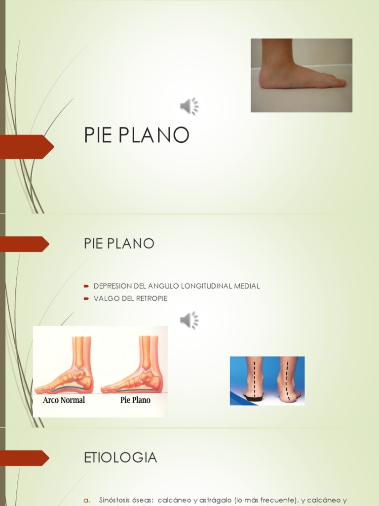 Pie Plano | PDF | Pie | Anatomía del miembro inferior