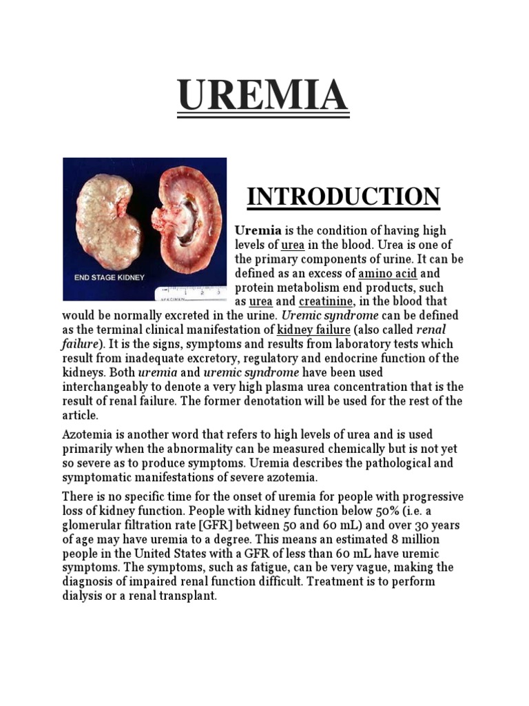 UREMIA | PDF | Kidney | Medicine