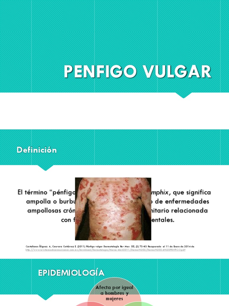 Penfigo Vulgar | PDF | Dermatología | Condiciones cutáneas
