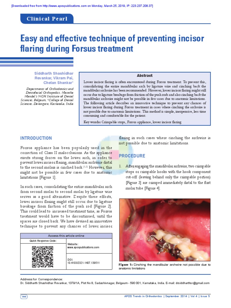 Prevent Incisor Flaring in Fixed Functional Appliance | PDF ...