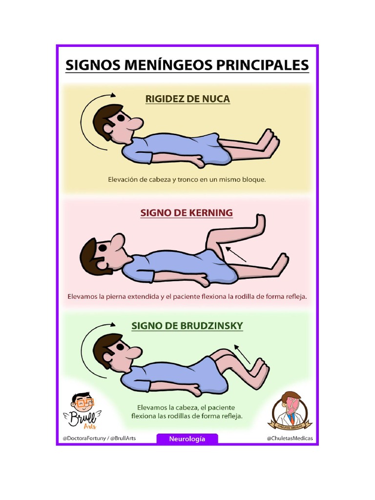 Signos Meningeos | PDF