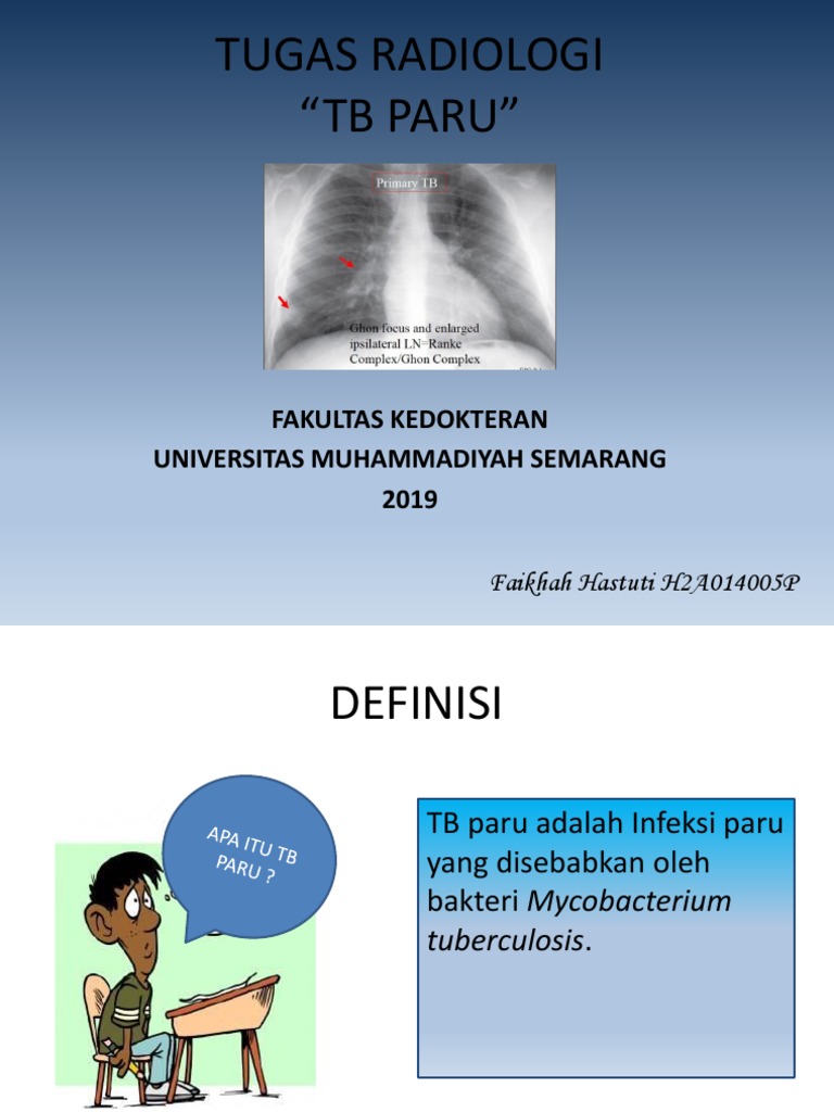 Tugas Radiologi - TB Paru | PDF | Sains & Matematika