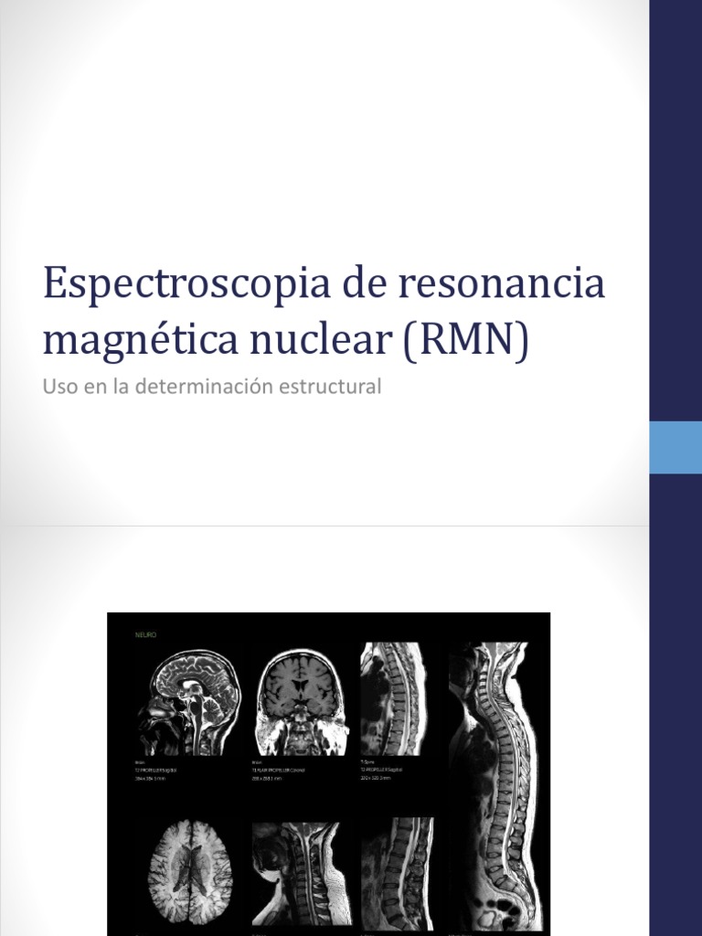 Espectroscopia de RMN: Fundamentos y Aplicaciones | PDF | Resonancia ...