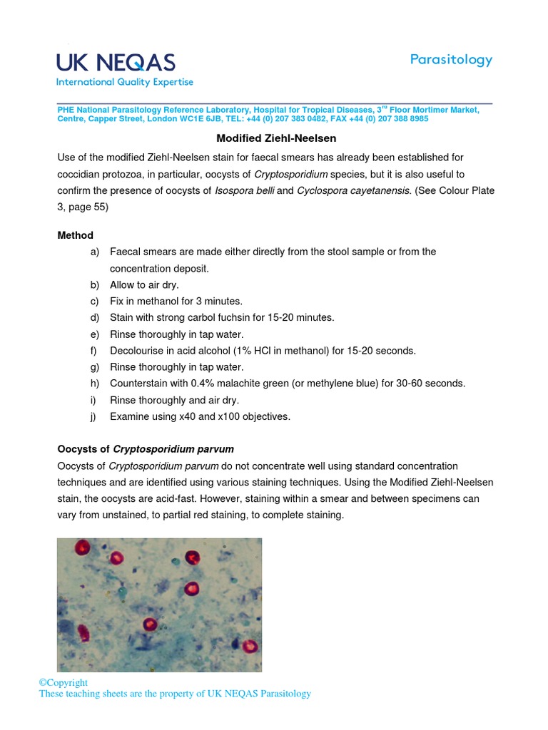 Modified Ziehl-Neelsen: Method | PDF | Staining | Microscopy