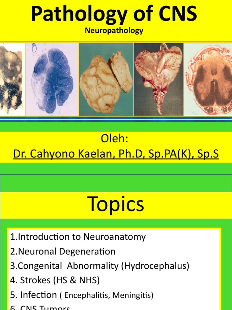 A Comprehensive Review of Central Nervous System Pathologies ...
