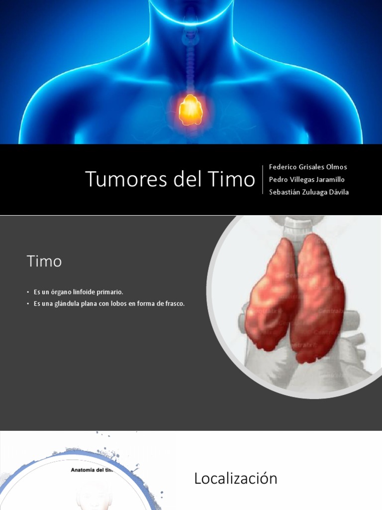 Tumores Del Timo | PDF | Timo | Cáncer