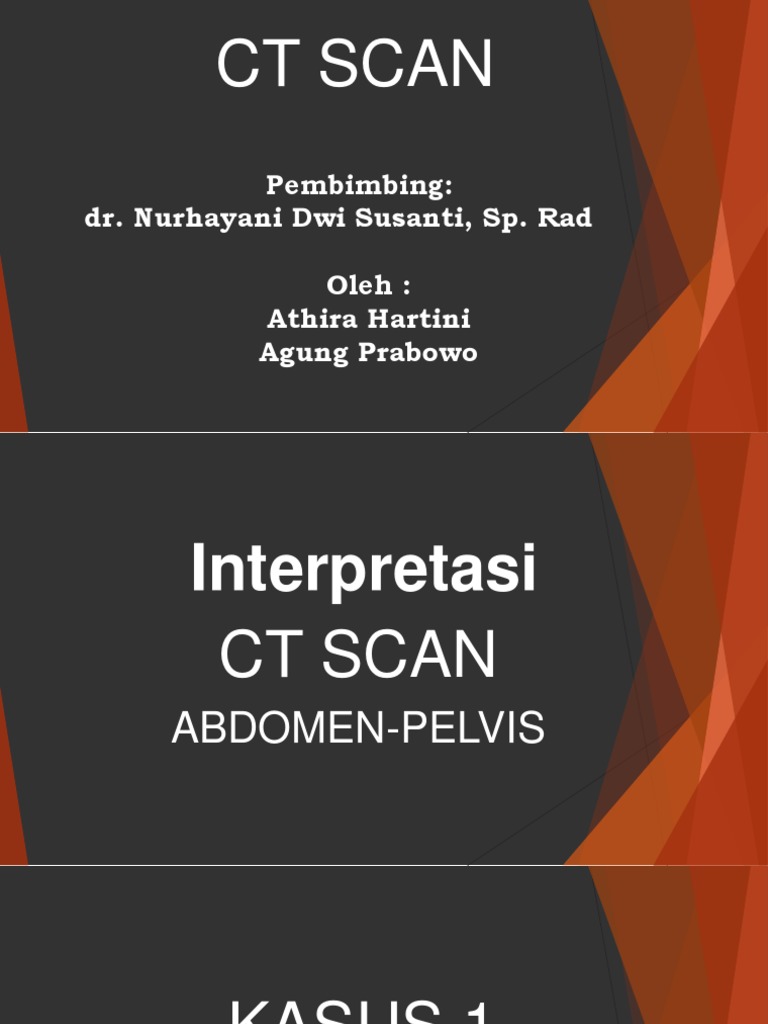 Slide PPT CT Scan | PDF