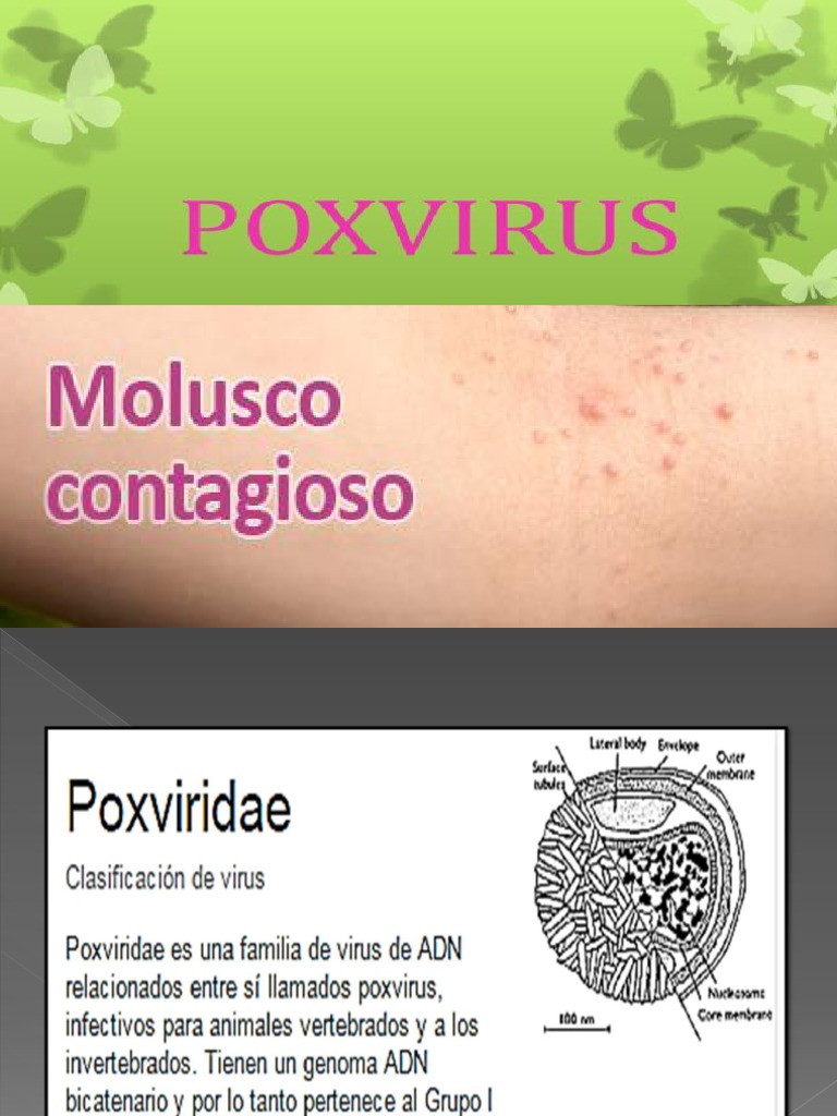 Poxviridae | PDF | Salud pública | Especialidades Medicas