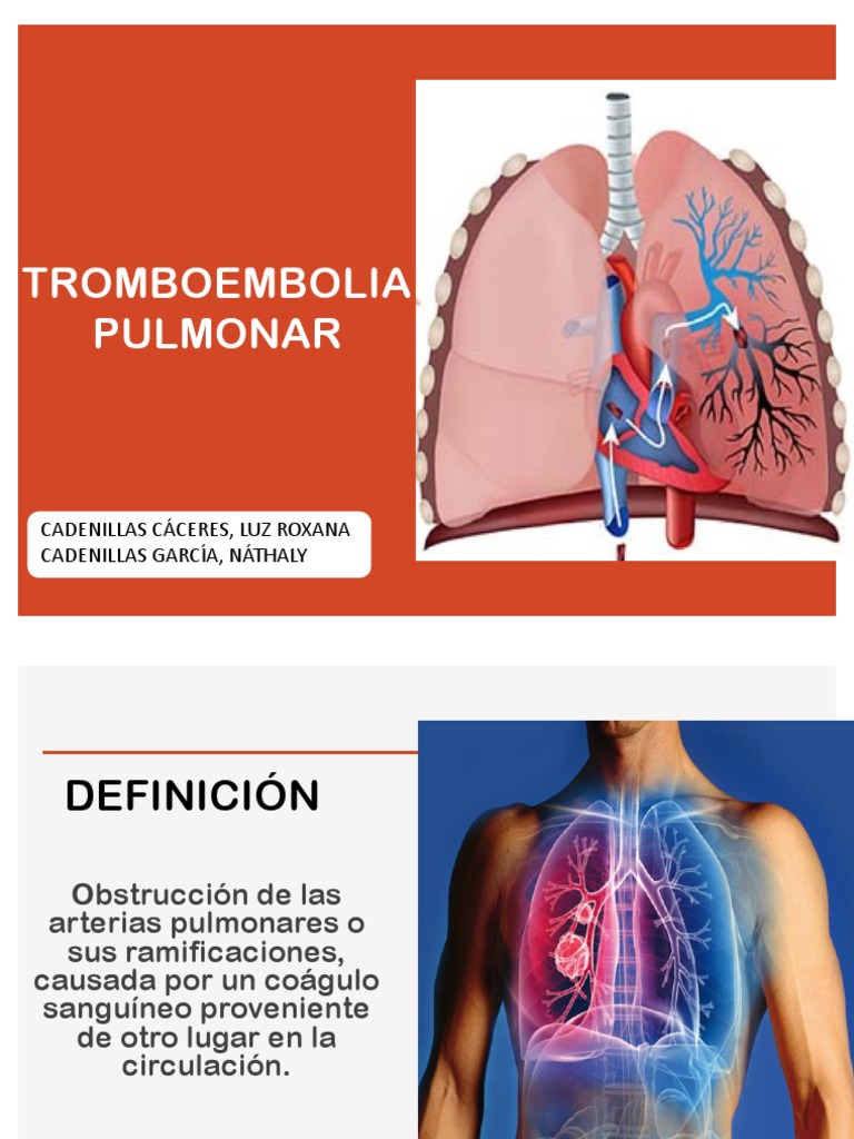 1 Exposicion Tromboembolia Pulmonar - DR Alvitez | PDF | Especialidades ...