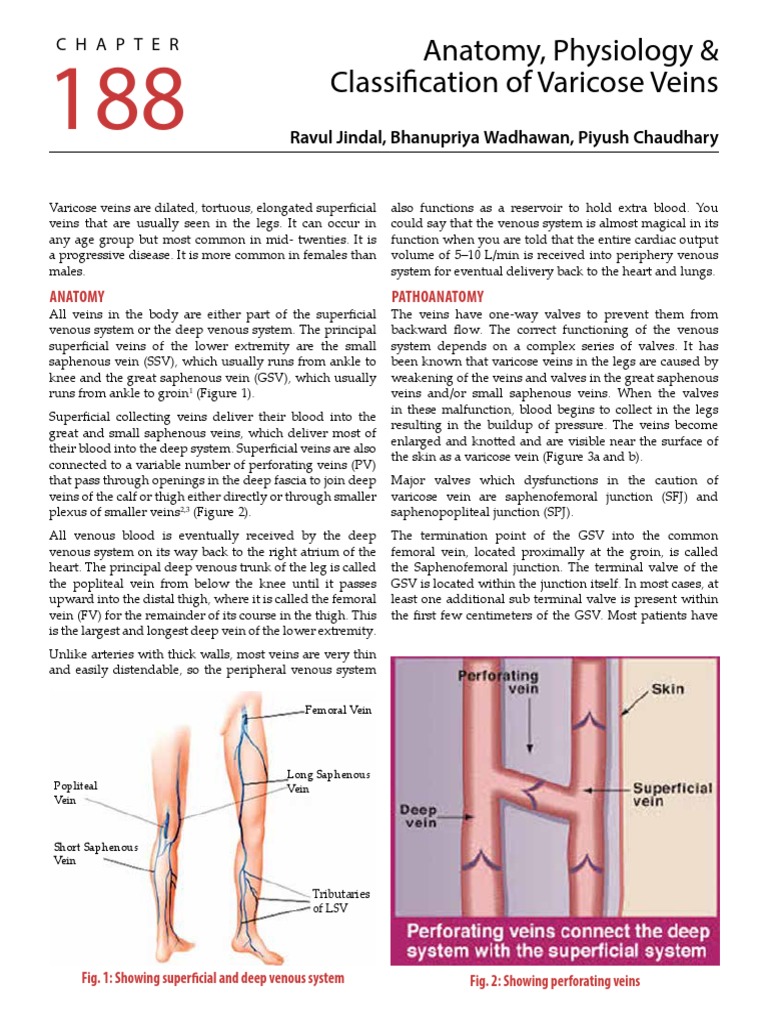 Anatomy, Physiology & Classification of Varicose Veins: Ravul Jindal ...