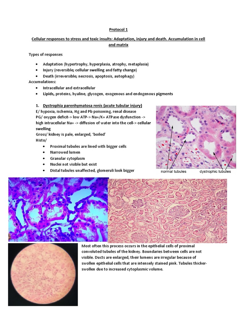 Pathology Slides 1 | PDF | Thrombus | Embolism