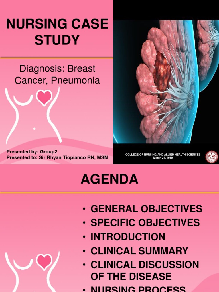 Nursing Case Study: Diagnosis: Breast Cancer, Pneumonia | PDF | Breast ...