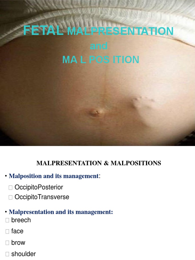 Malpositions and Malpresentations Final | PDF | Caesarean Section ...