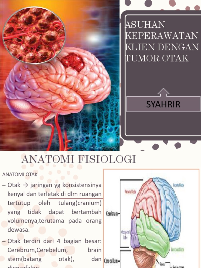 Askep Tumor Otak | PDF
