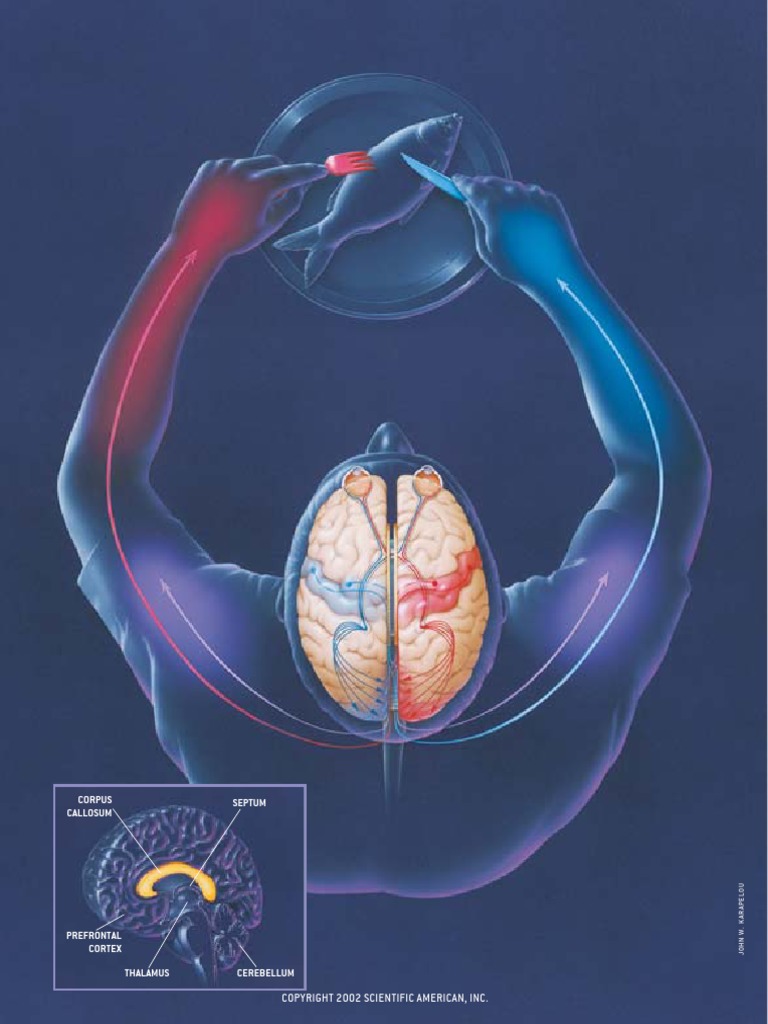 Splitbrain PDF | PDF | Lateralization Of Brain Function | Central ...