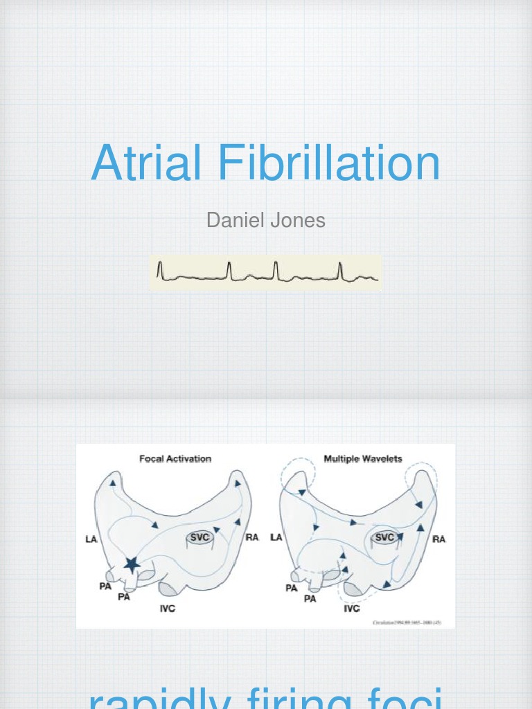 Atrial Fibrillation Medicine Presentation | PDF | Heart | Internal Medicine