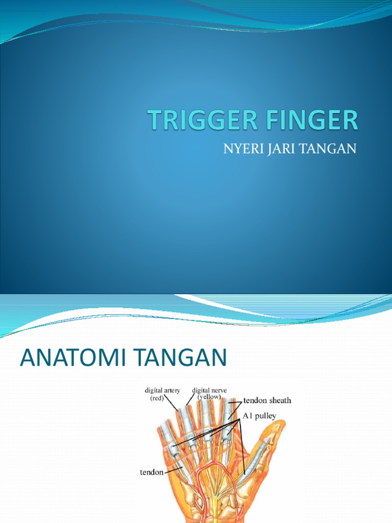 Trigger Finger | PDF