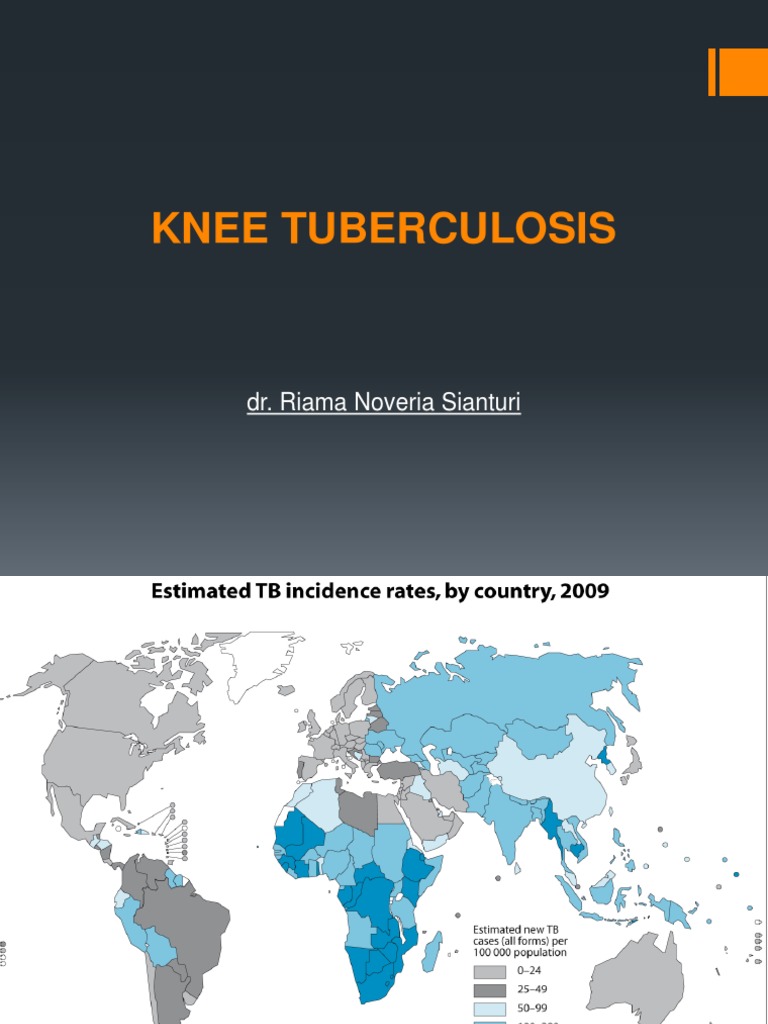 Knee Tuberculosis: Dr. Riama Noveria Sianturi | PDF | Knee | Arthritis