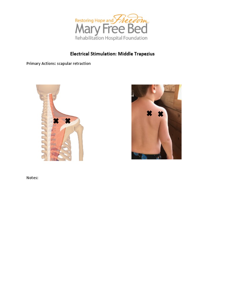 Middle Trapezius | PDF