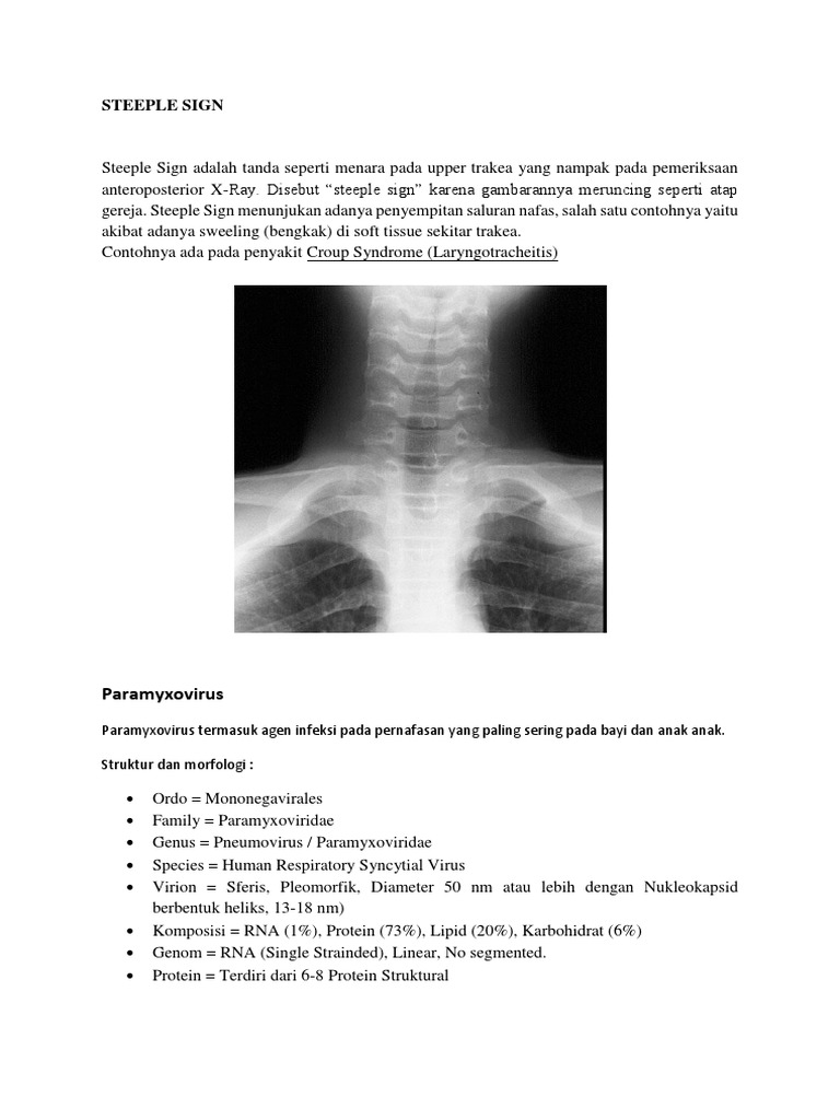 Tanda Steeple Sign | PDF