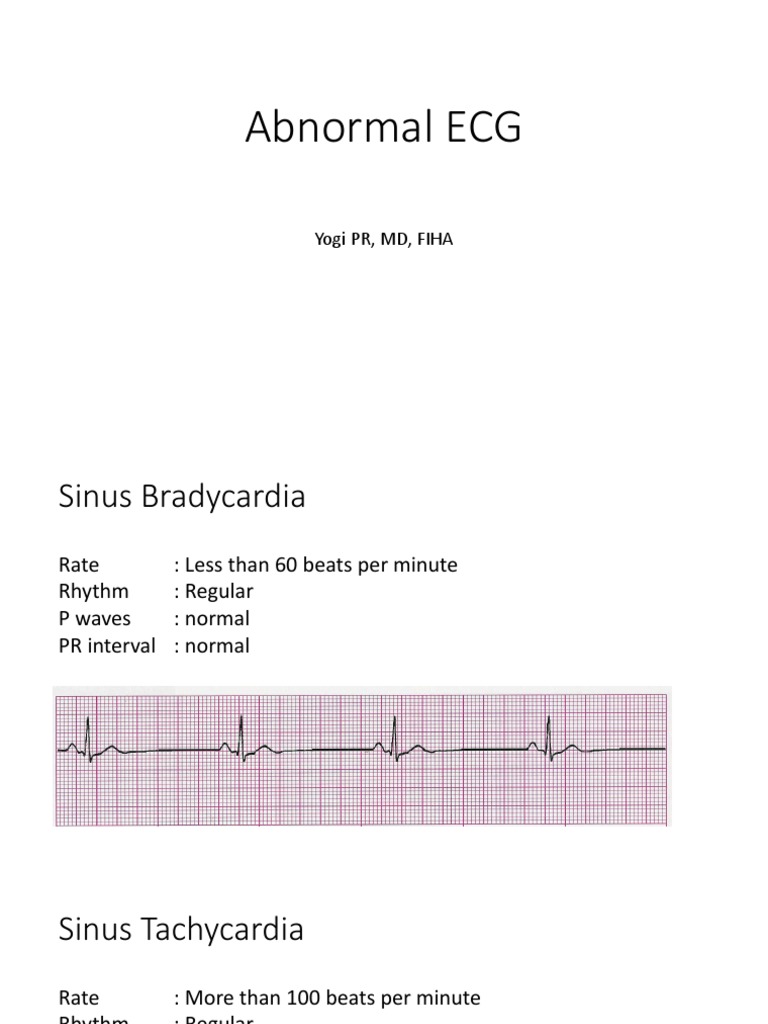 Abnormal ECG 1 | PDF | Internal Medicine | Physiology