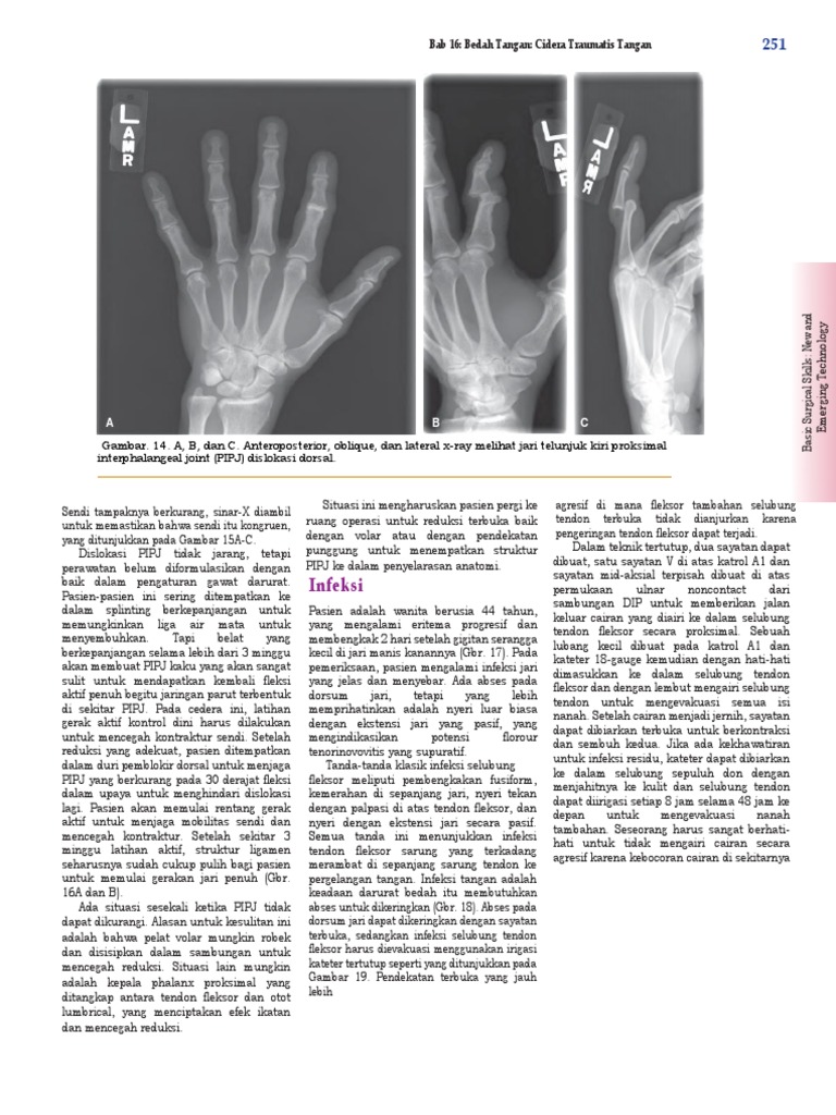 Fischer Mastery of Surgery 6th Ed-251-501 (Repaired) | PDF
