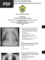 Diagnosis Banding Opasitas Pada Rontgen Thorax | PDF | Kajian Bahasa ...