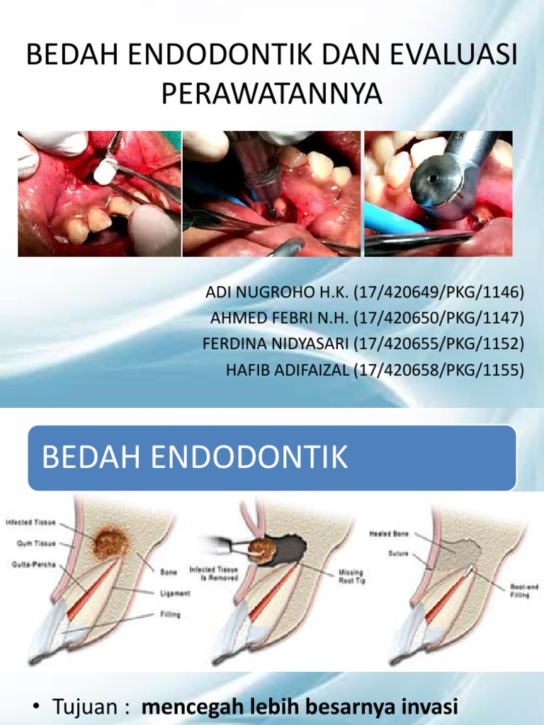 Bedah Endodontik Dan Evaluasi Perawatannya | PDF