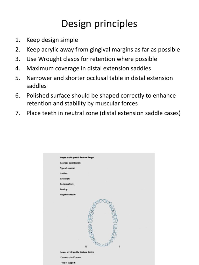 Removable Partial Denture Design | PDF
