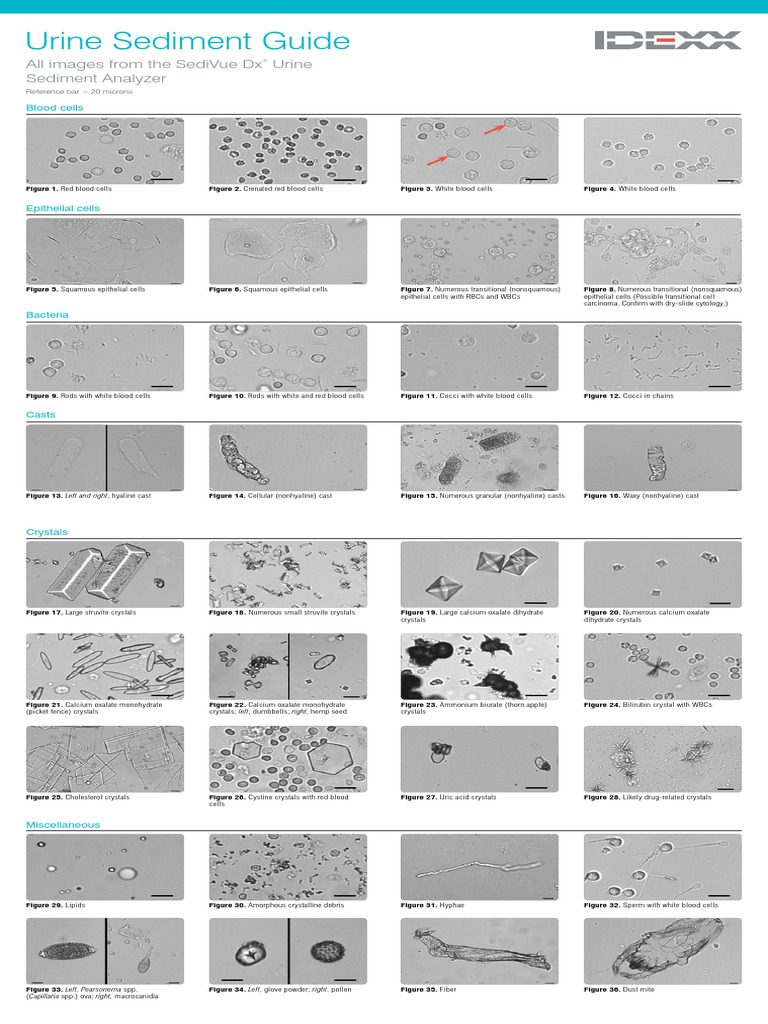 Sedivue Urine Sediment Guide | PDF | Medical Specialties | Anatomy