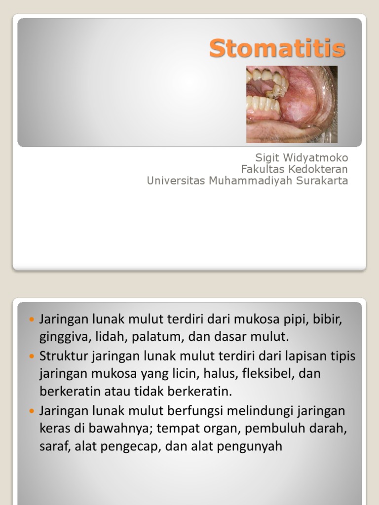 2019 DR - Sigit WIdyatmoko, SP - PD Stomatitis | PDF