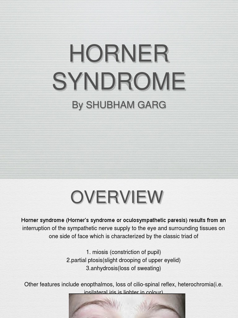 Understanding Horner's Syndrome Triad | PDF | Nervous System | Diseases ...