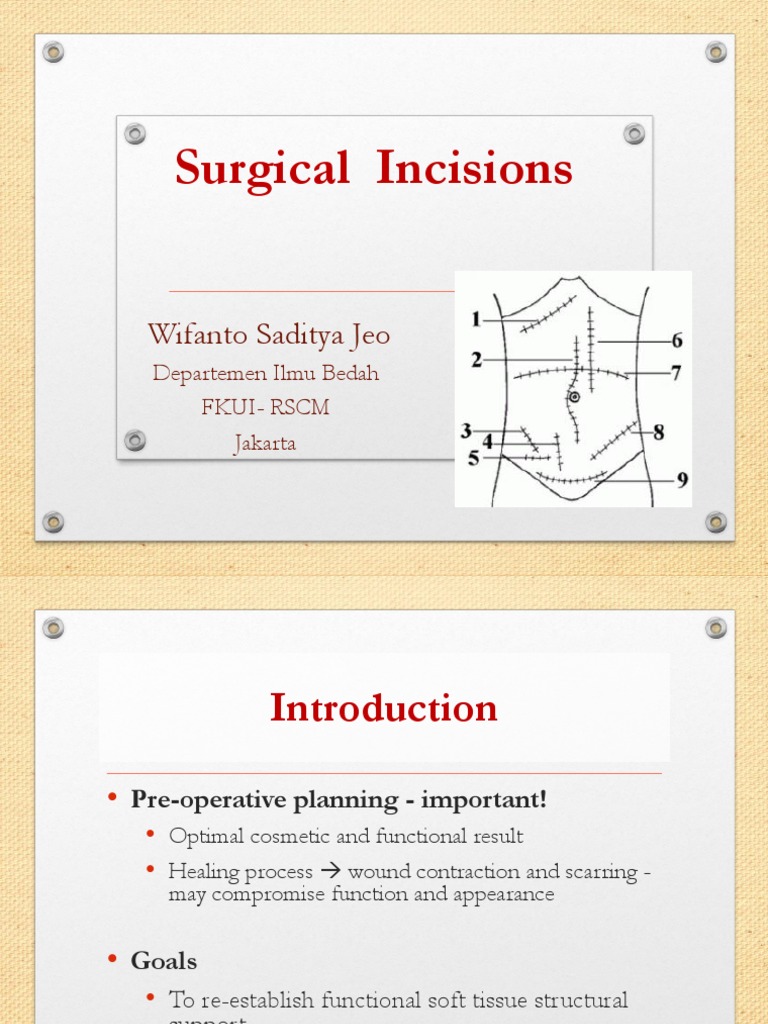 Surgical Incisions | PDF | Surgical Suture | Abdomen