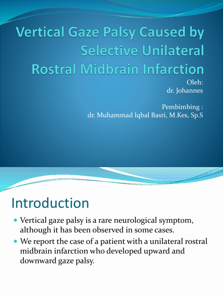 Vertical Gaze Palsy Caused by Selective Unilateral | PDF | Motor Neuron ...