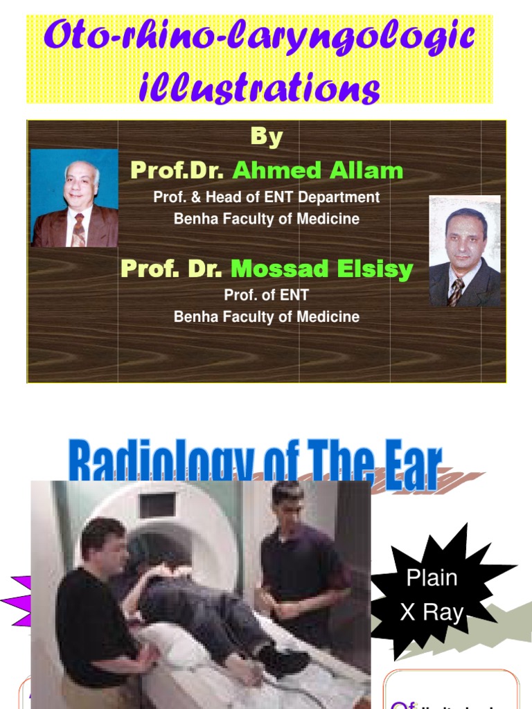 ENT and Head & Neck CT Imaging Examples | PDF | Esophagus | Human Nose