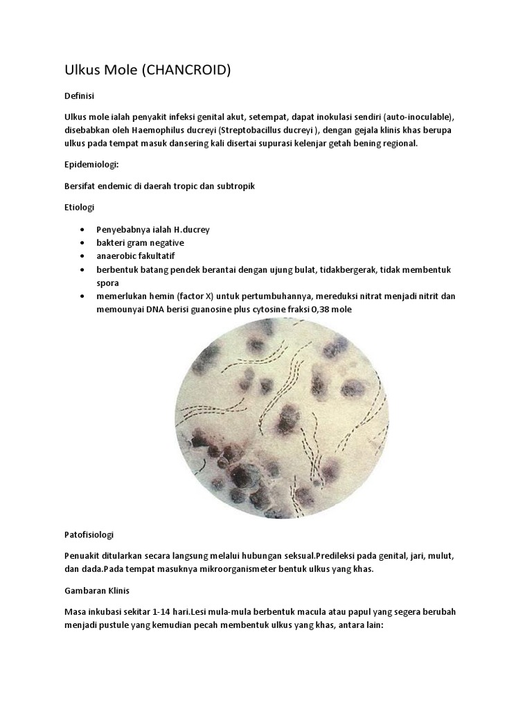 Ulkus Mole (Chancroid) | PDF