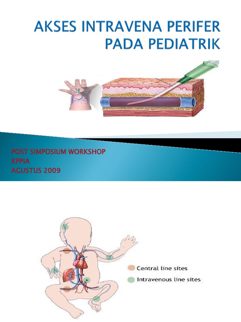 AKSES INTRAVENA PERIFER-KPPIA 09.ppt