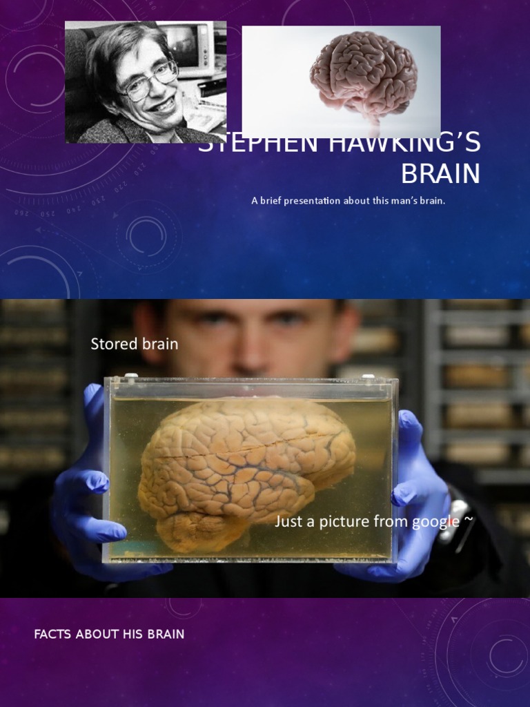 Stephen Hawking’s Brain