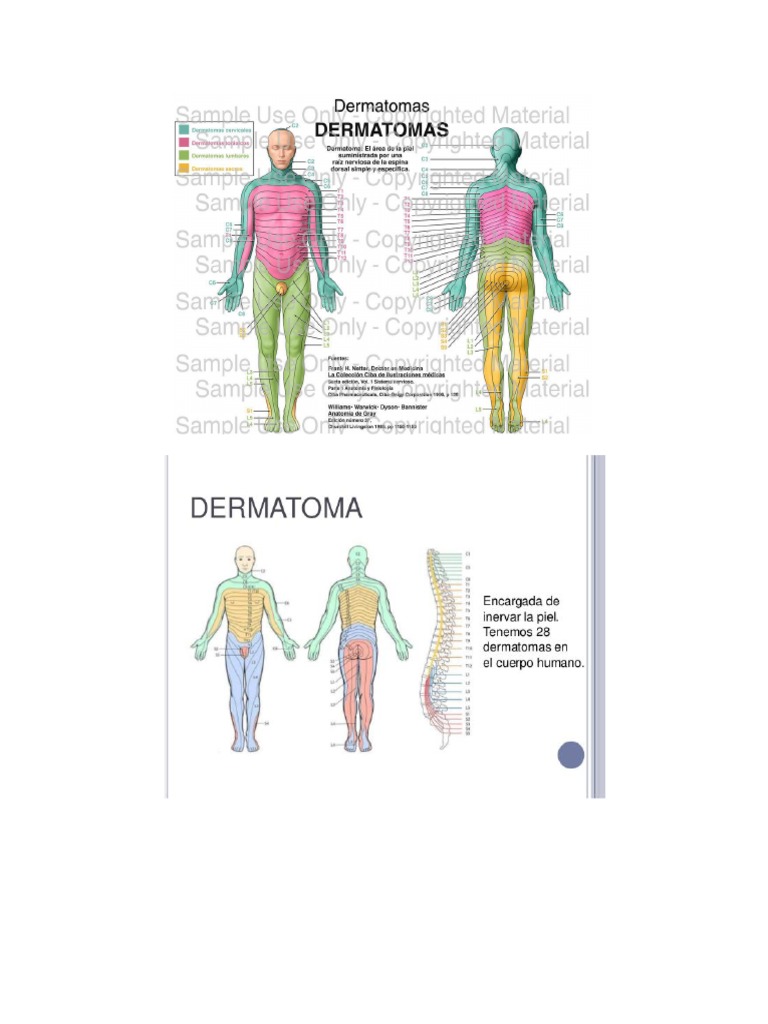 Dermatomas Brazo Mano Anatomia