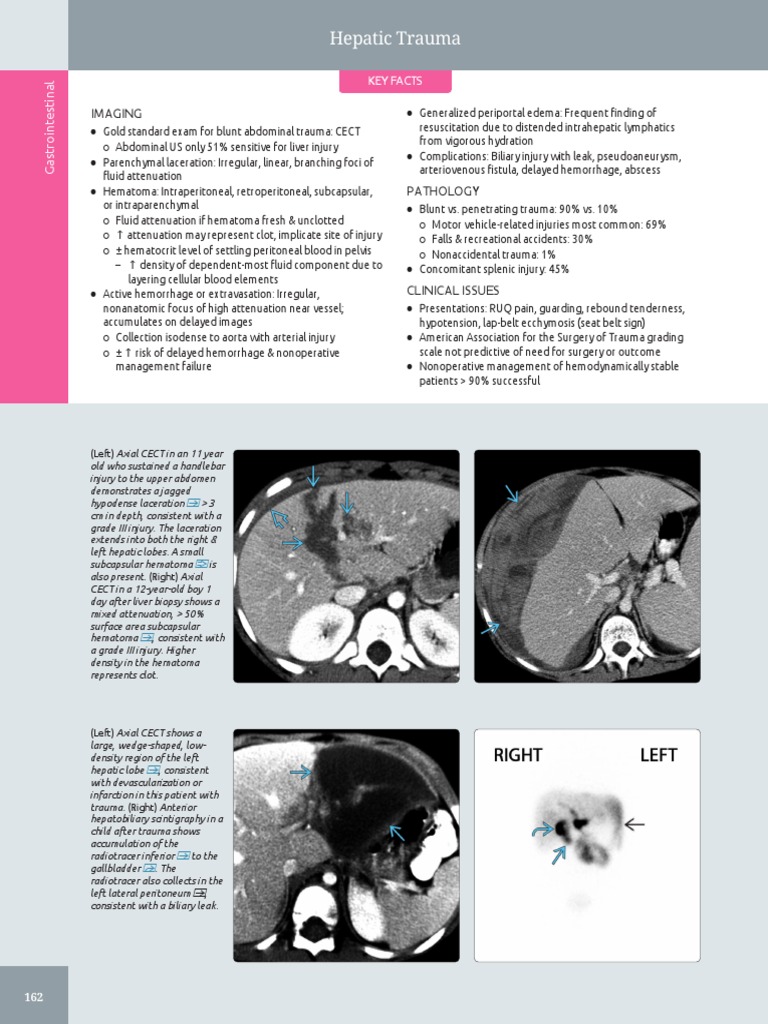 Hepatic Trauma: Imaging | PDF | Peritoneum | Liver