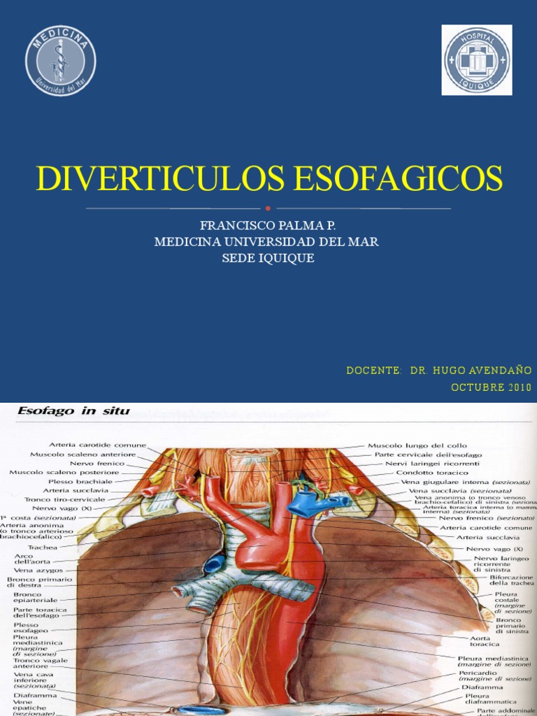 Divertículos esofágicos: causas, tipos y tratamiento | PDF ...
