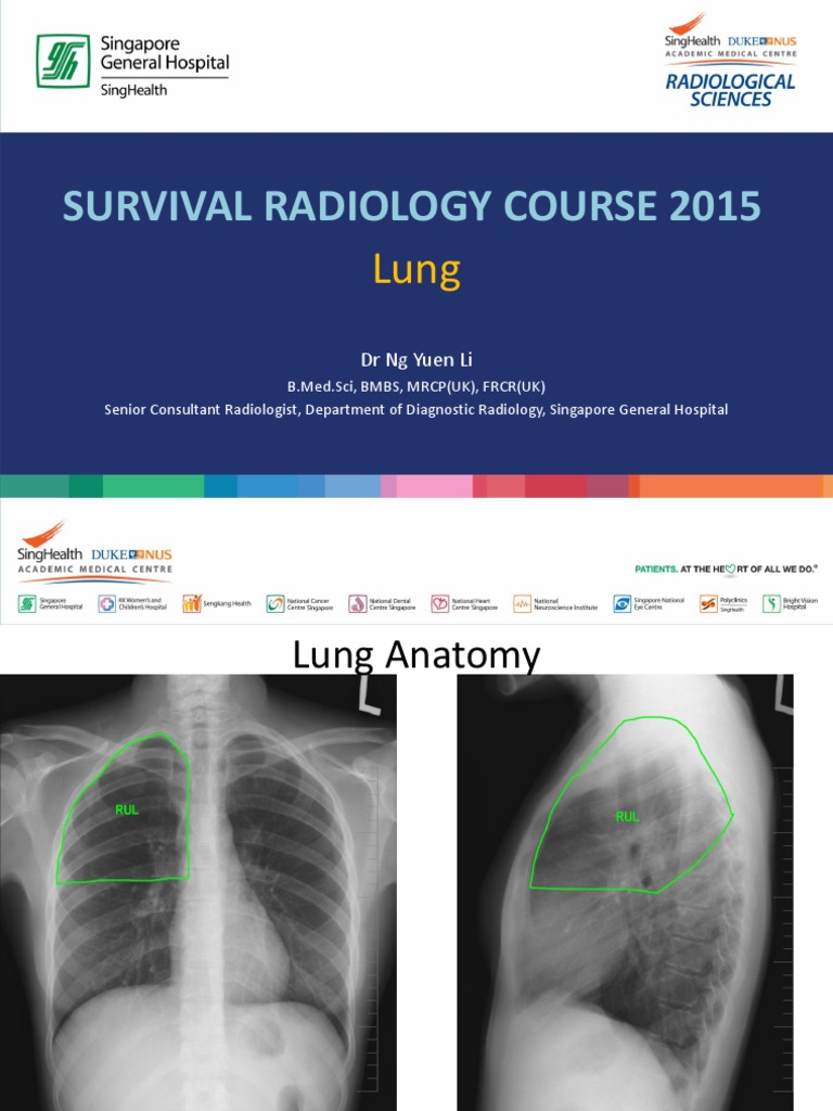 Survival Rad 15 - Lung Handout | PDF | Lung | Pneumonia