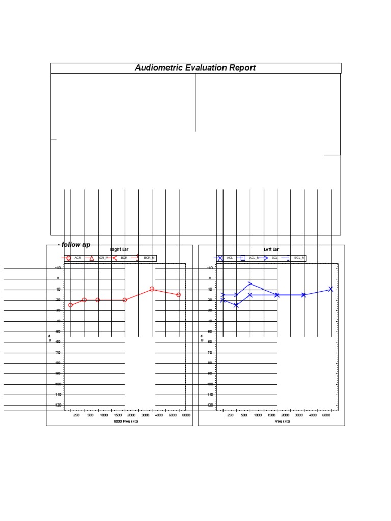 Audiometric Evaluation Report .: Left Ear Right Ear | PDF | Neurology ...