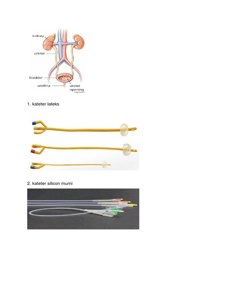 Jenis Jenis Kateter | PDF