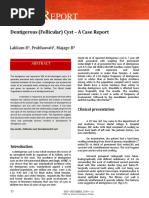 Resesi Miller Klas Iii | PDF | Periodontology | Health Care