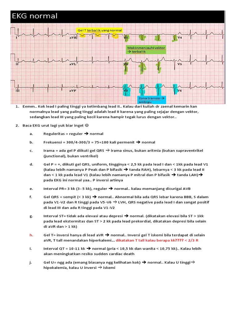 Cara Baca EKG: Panduan Lengkap | PDF | Metode & Bahan Ajar | Kesehatan ...