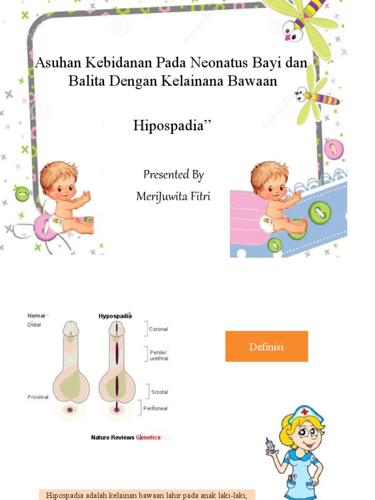 Hipospadia | PDF